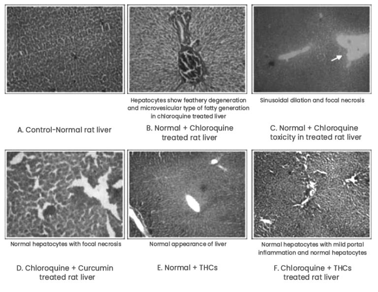 Hepatoprotective potential – Curcumin C3 Reduct®
